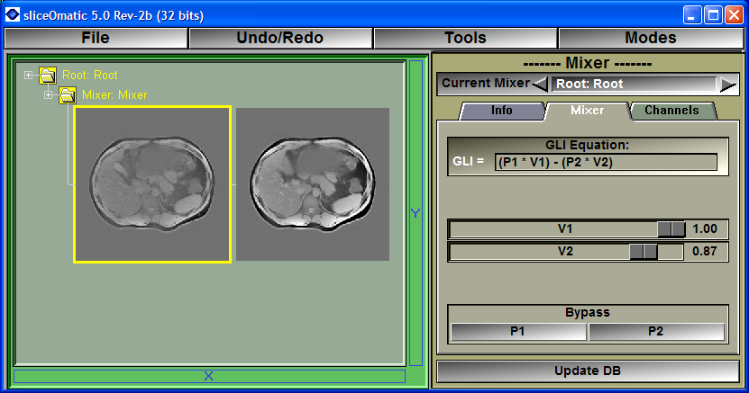 sliceOmatic - TOMOVISION
