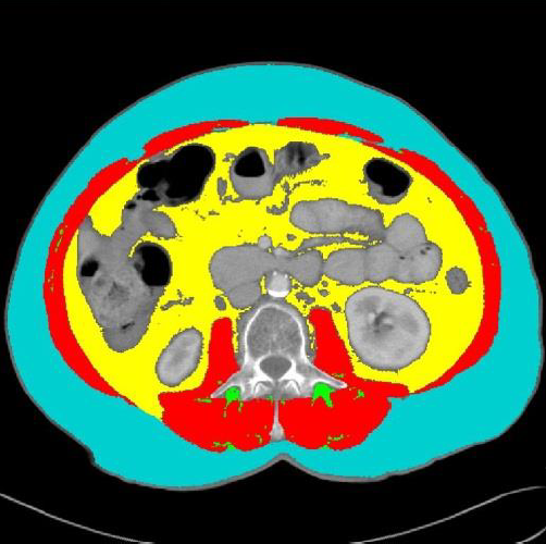 Step 3b: Segmentation L3 (Manual)