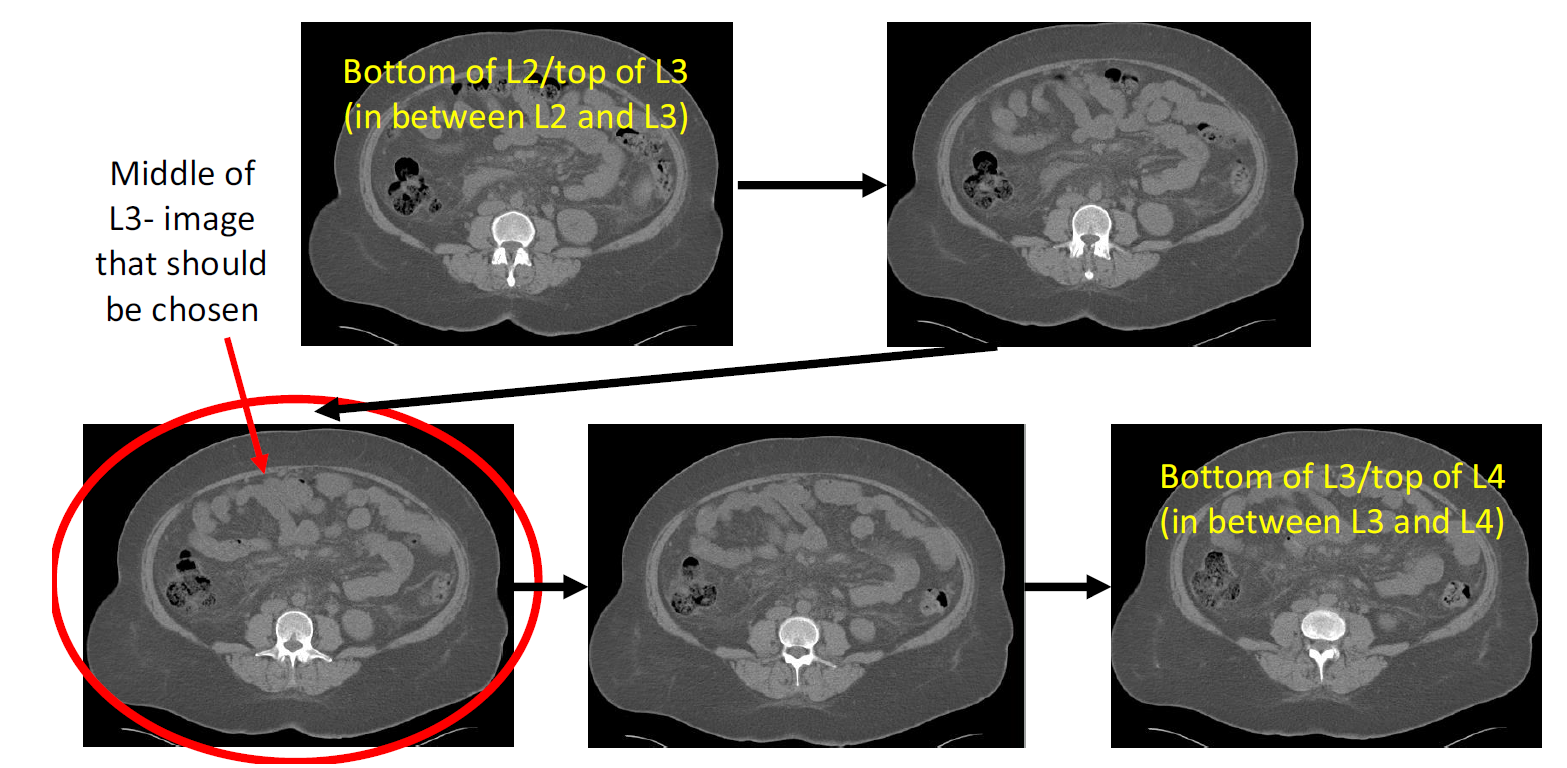 Landmarking Guide: Axial