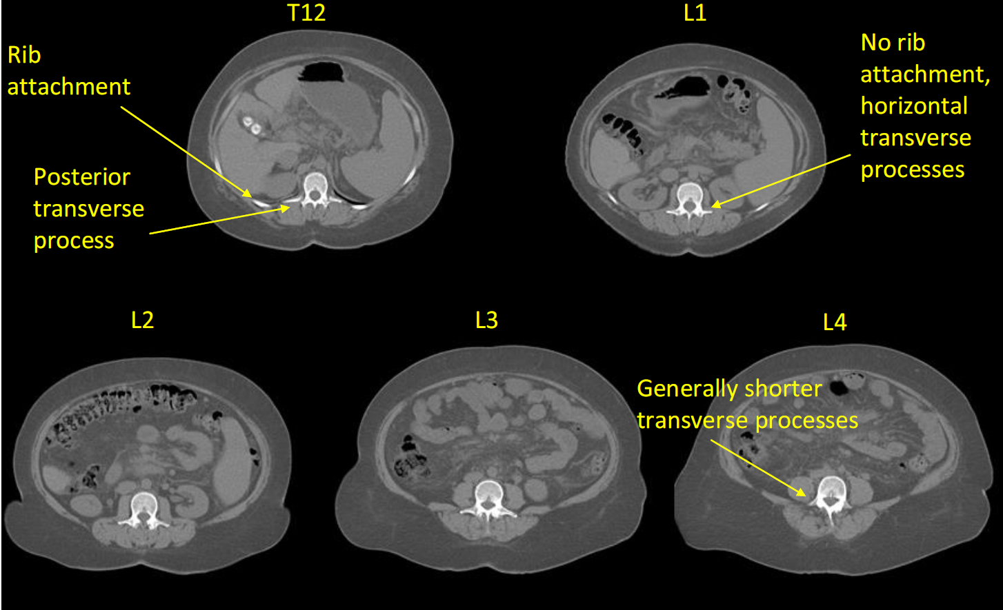 Landmarking Guide: Axial