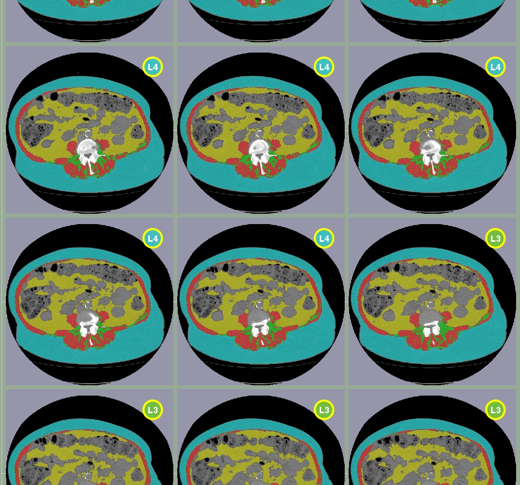 sliceOmatic - TOMOVISION